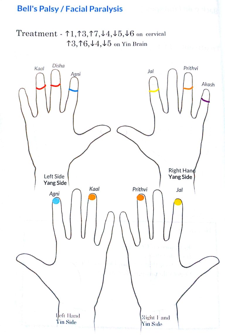 Color therapy for Facial Paralysis, Bell’s Palsy – Heal with Colors