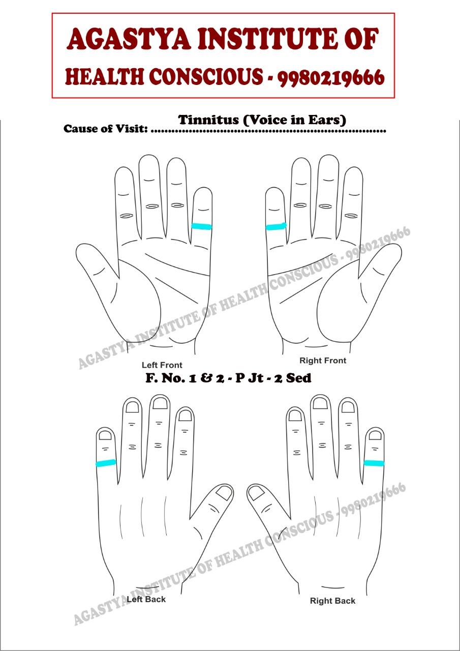Tinnitus – Heal with Colors